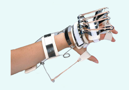 Dinamik el-el bileği splinti (radial palsy) – Akses Ortopedi
